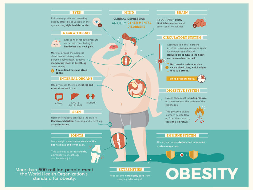 What Is Obesity Overview Of Obesity Blue Guys News What Is Obesity Overview Of Obesity Blue Guys News
